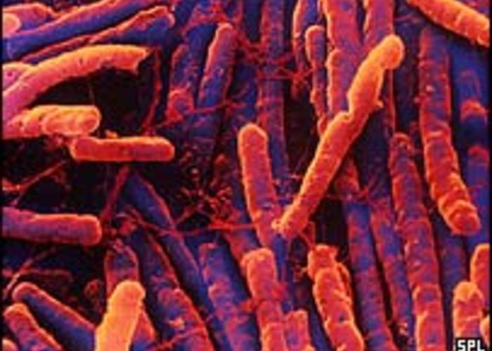 3 Crazy Things Fecal Transplants Could Treat | Health News Florida